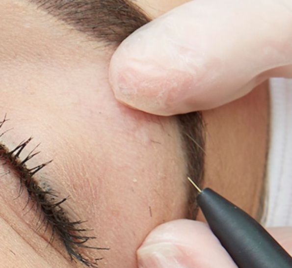 Eyebrow Waxing in Osaka: What You Need to Know vs. Electrolysis